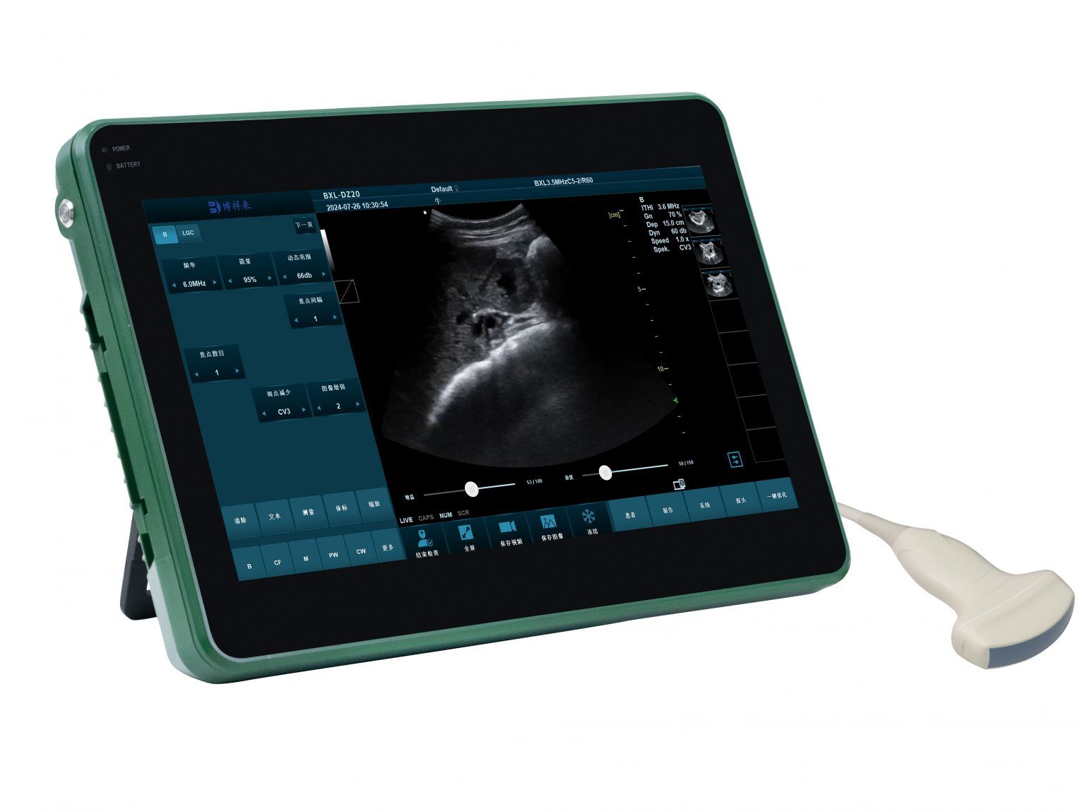 Portable Color Ultrasound Diagnostic Instrument Price